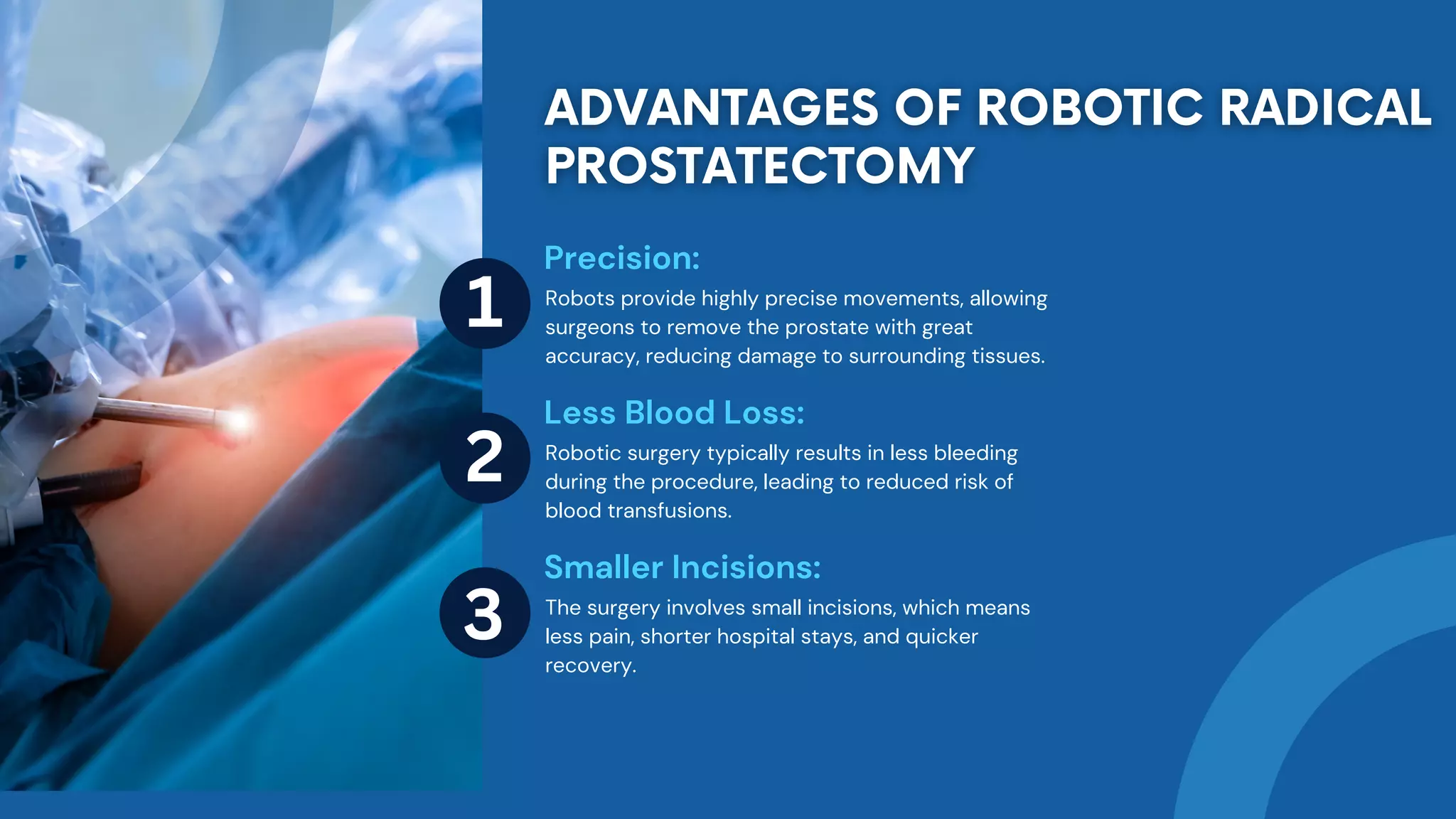 The Role Of Robotic Radical Prostatectomy pdf