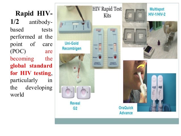 The role of the clinical lab in diagnosis of hiv
