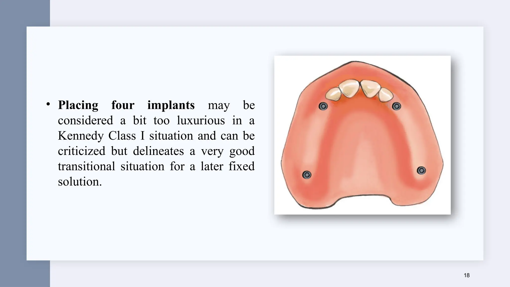 The Role of the Dental Implant in RPD_JC.pptx