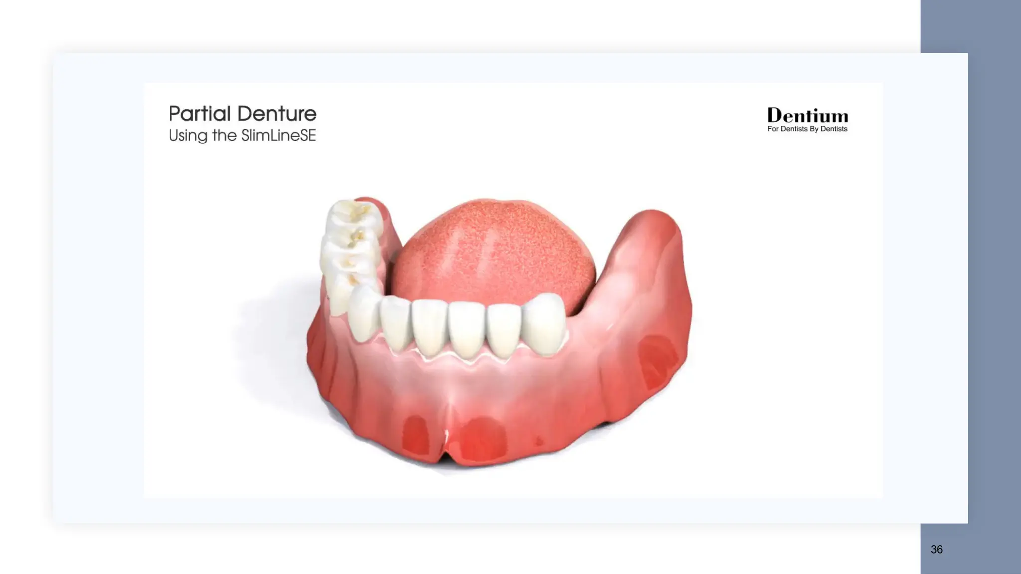 The Role of the Dental Implant in RPD_JC.pptx
