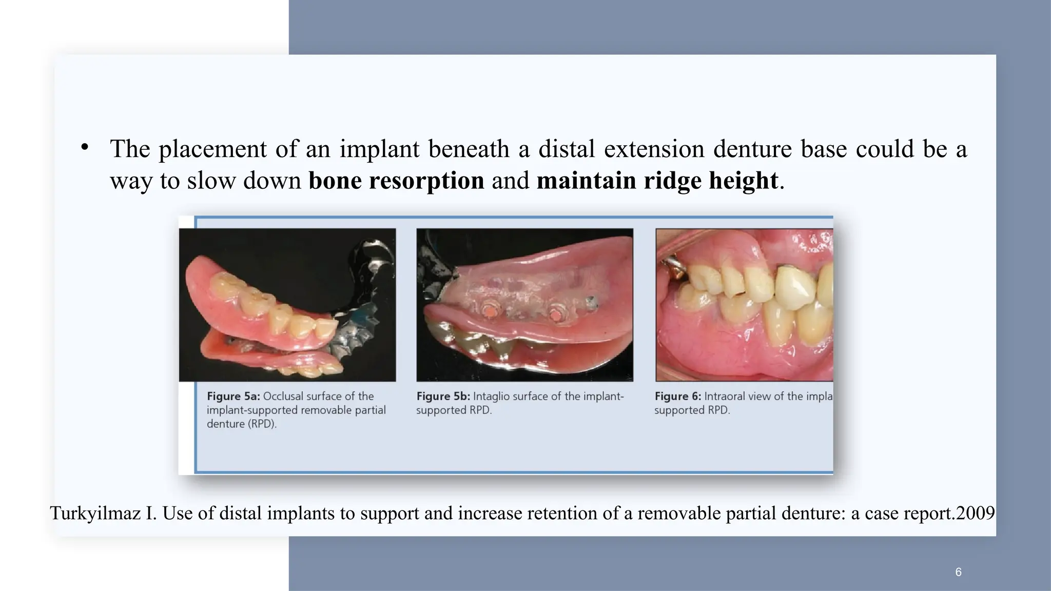 The Role of the Dental Implant in RPD_JC.pptx | Dental Health ...