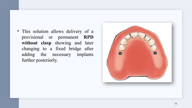 The Role of the Dental Implant in RPD_JC.pptx | Dental Health ...