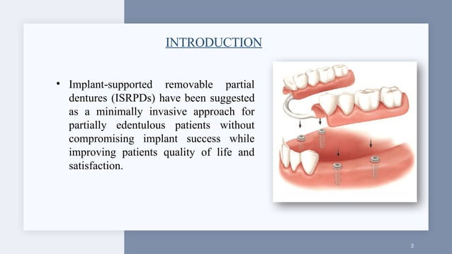 The Role of the Dental Implant in RPD_JC.pptx | Dental Health ...