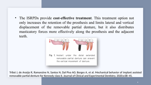 The Role of the Dental Implant in RPD_JC.pptx | Dental Health ...