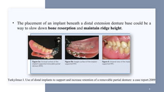 The Role of the Dental Implant in RPD_JC.pptx