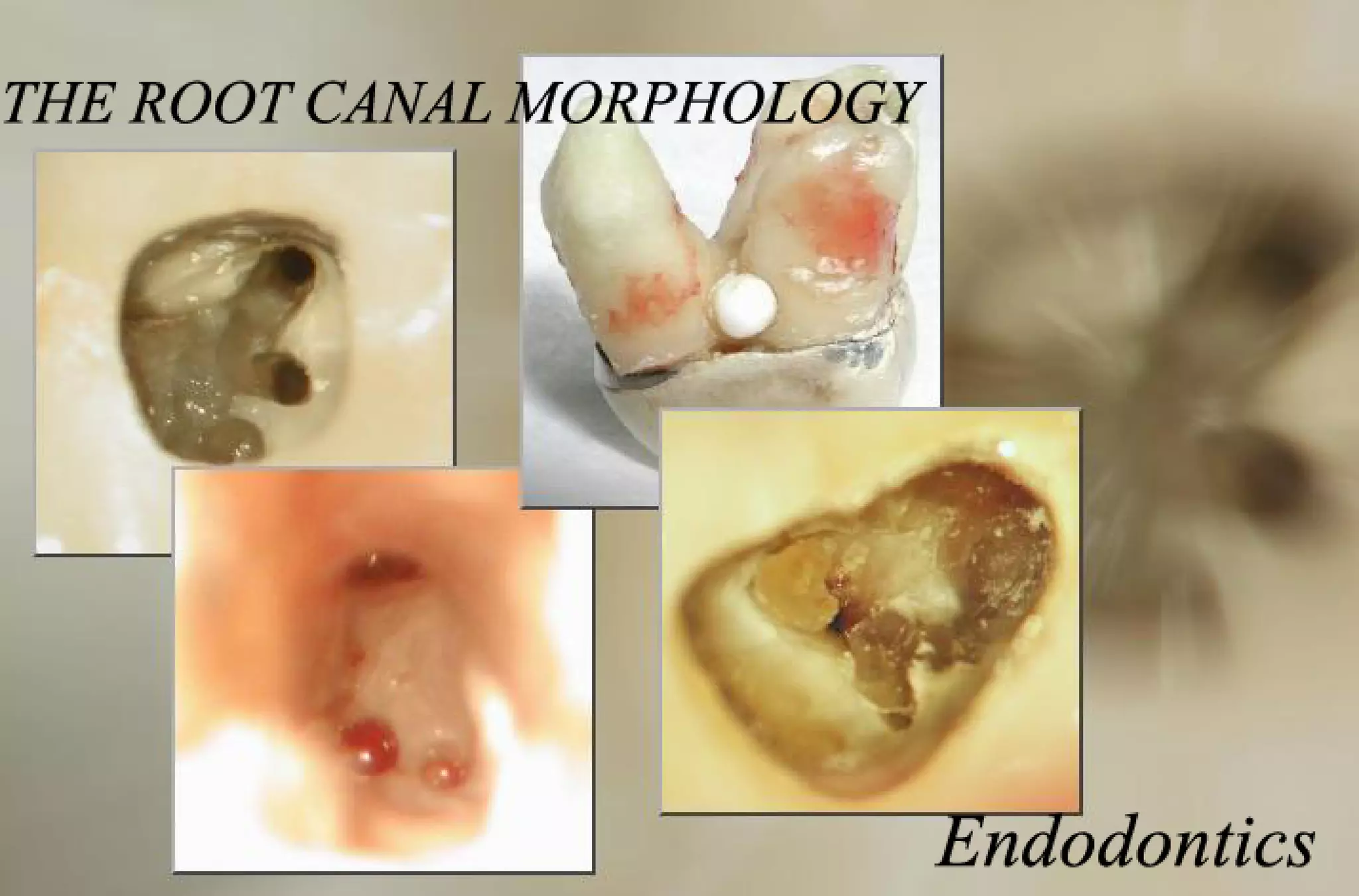 Root Canal Morphology | PDF