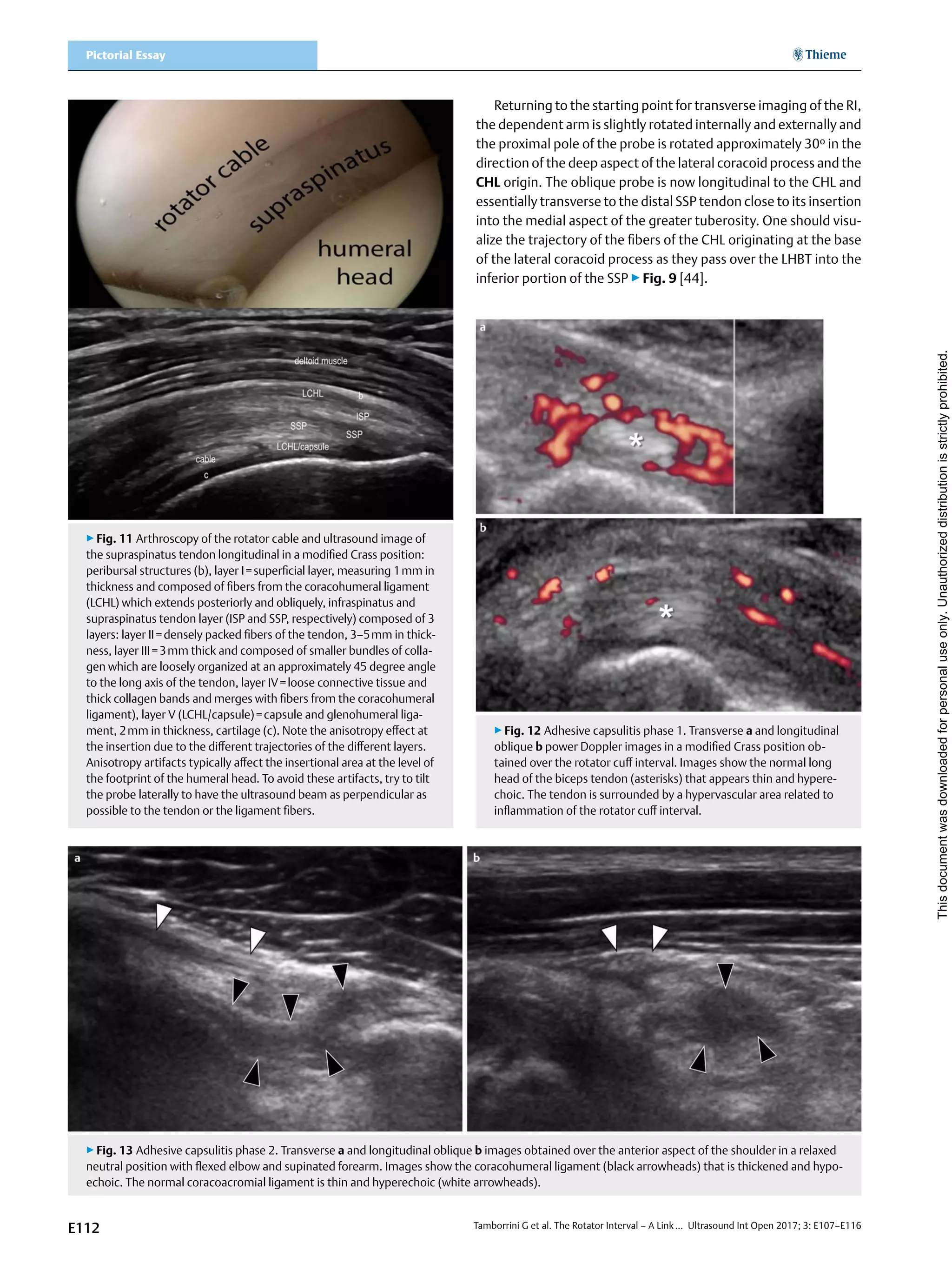 The Rotator Interval A Link Between Anatomy and Ultrasound.pdf