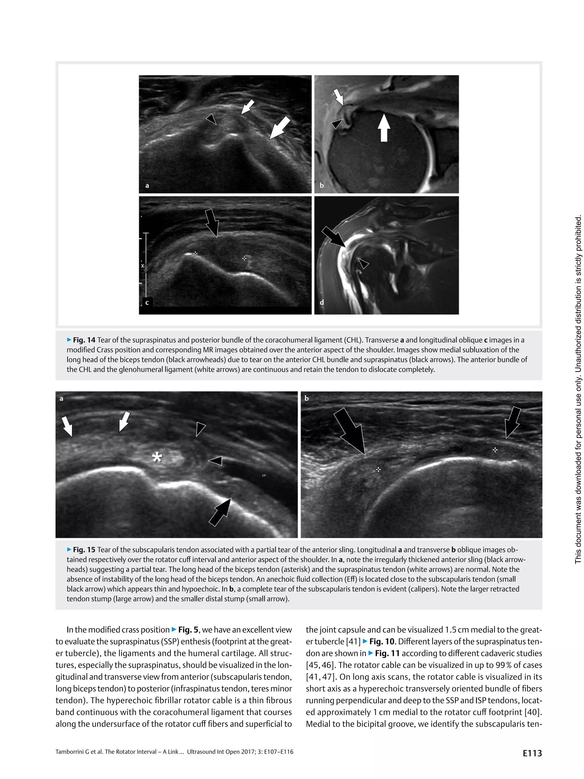 The Rotator Interval A Link Between Anatomy and Ultrasound.pdf