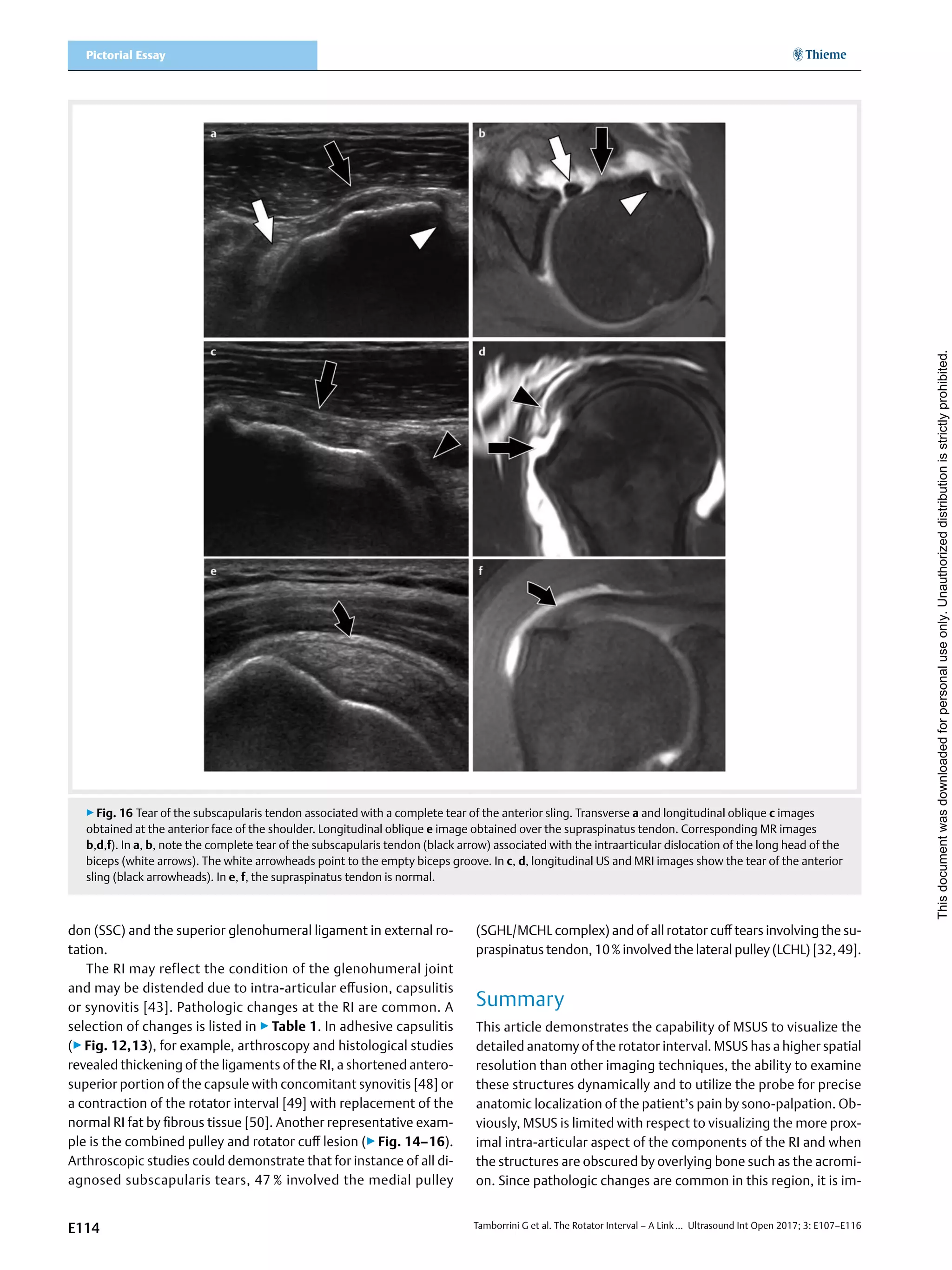 The Rotator Interval A Link Between Anatomy and Ultrasound.pdf