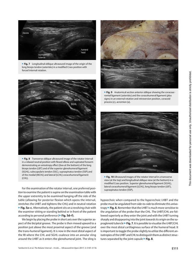 The Rotator Interval A Link Between Anatomy and Ultrasound.pdf