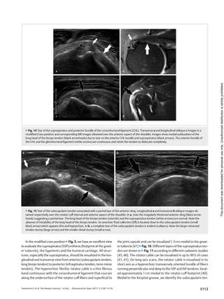 The Rotator Interval A Link Between Anatomy and Ultrasound.pdf