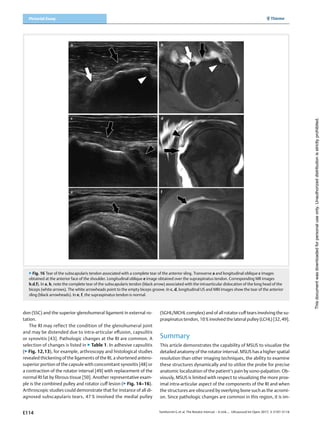 The Rotator Interval A Link Between Anatomy and Ultrasound.pdf