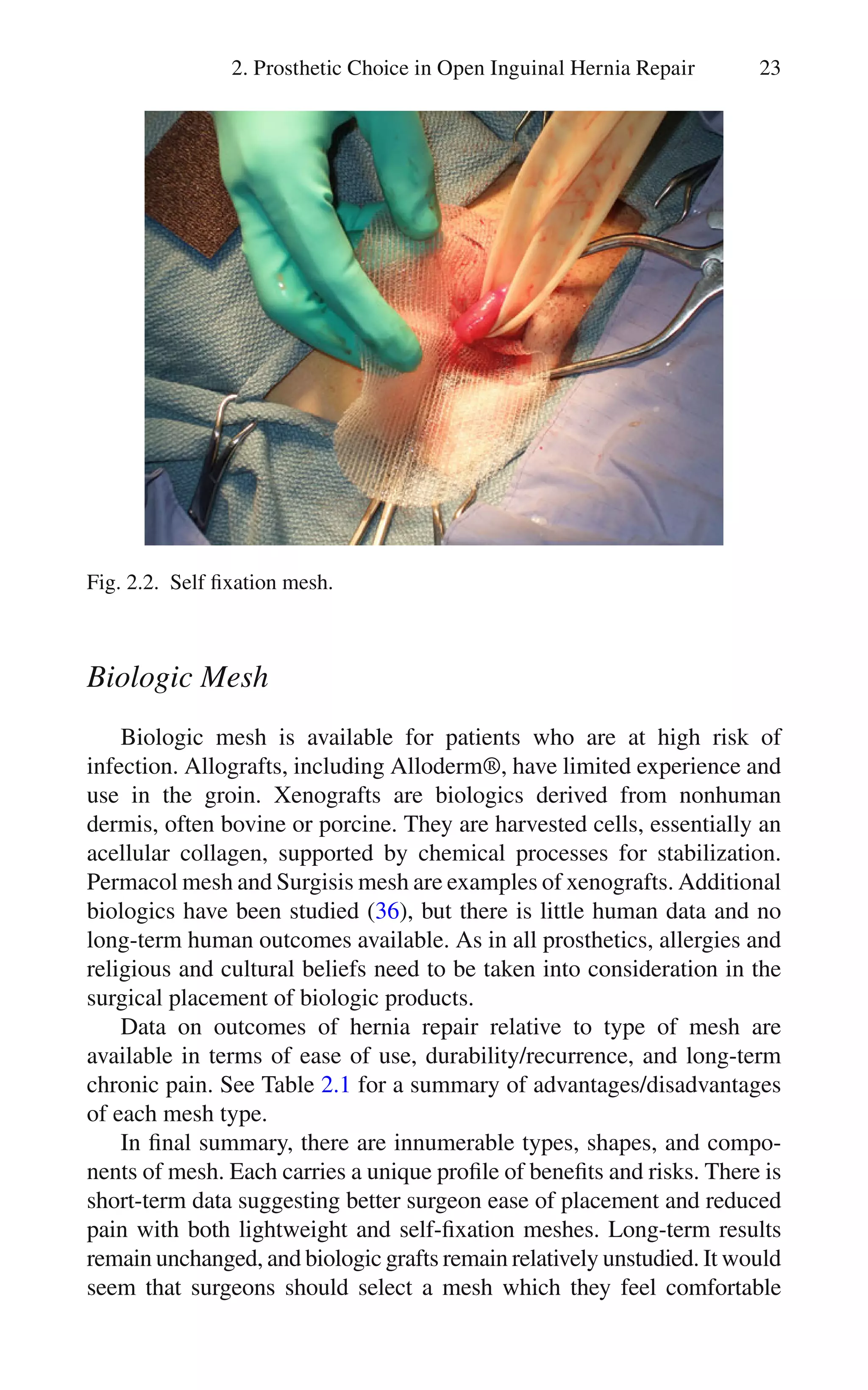 The sages manual of hernia repair | PDF