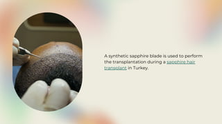 The Sapphire Technique for Hair Transplant | PDF