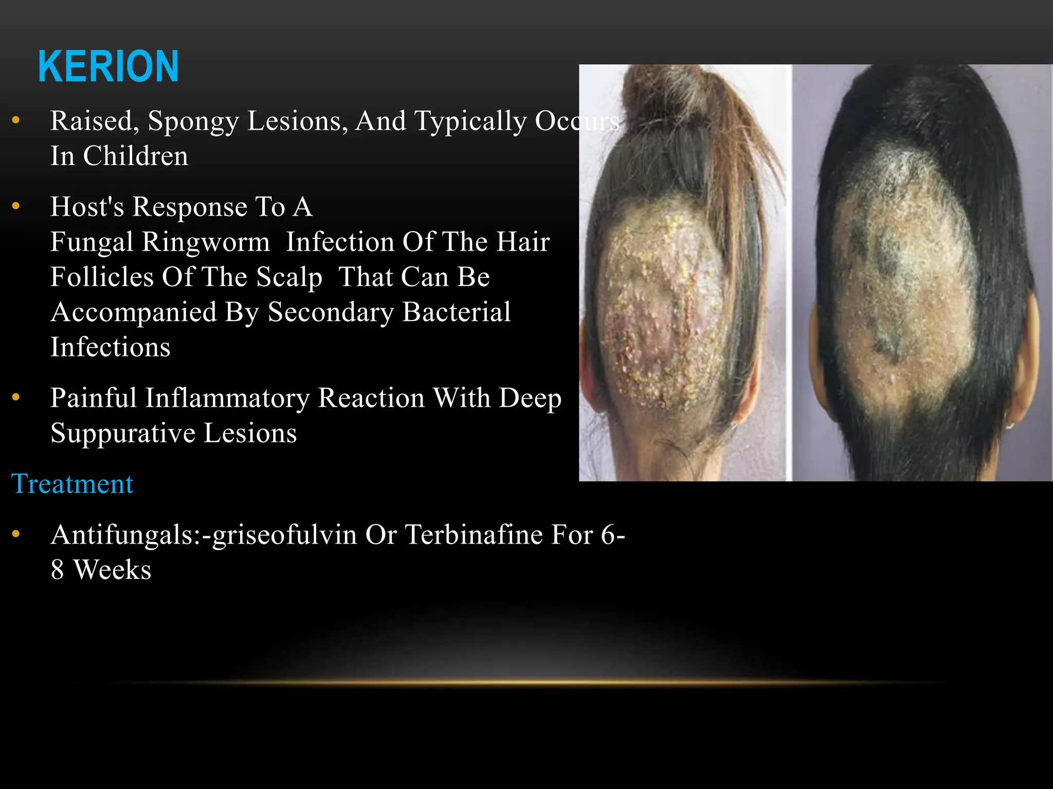 The scalp, hair & its applied anatomy | PPTX