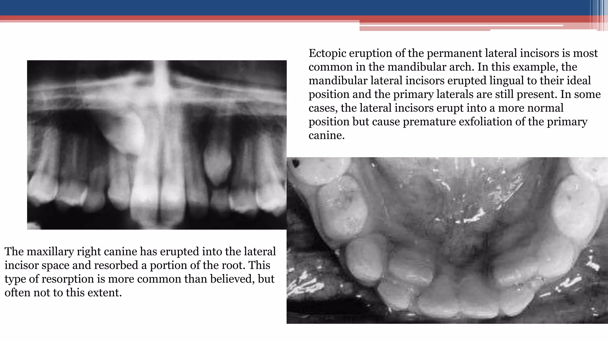 The School Age Child and Dental Considerations | PPTX