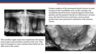 The School Age Child and Dental Considerations | PPTX