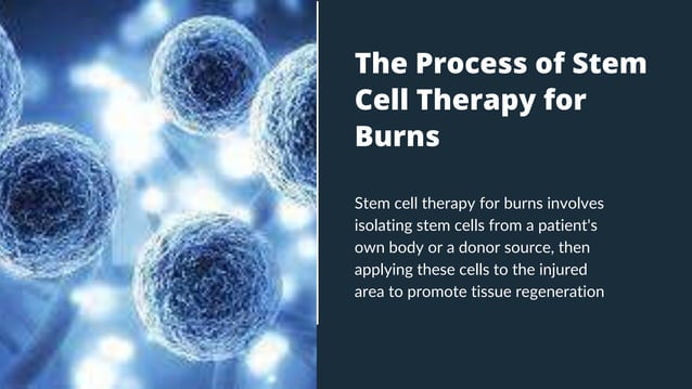 The Science of Healing Dr. David Greene on Stem Cells for Burn Injuries ...