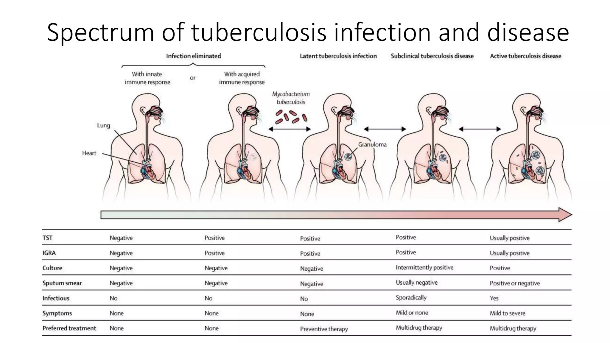 Connecting the dots with science: Latent TB, active TB disease, and ...