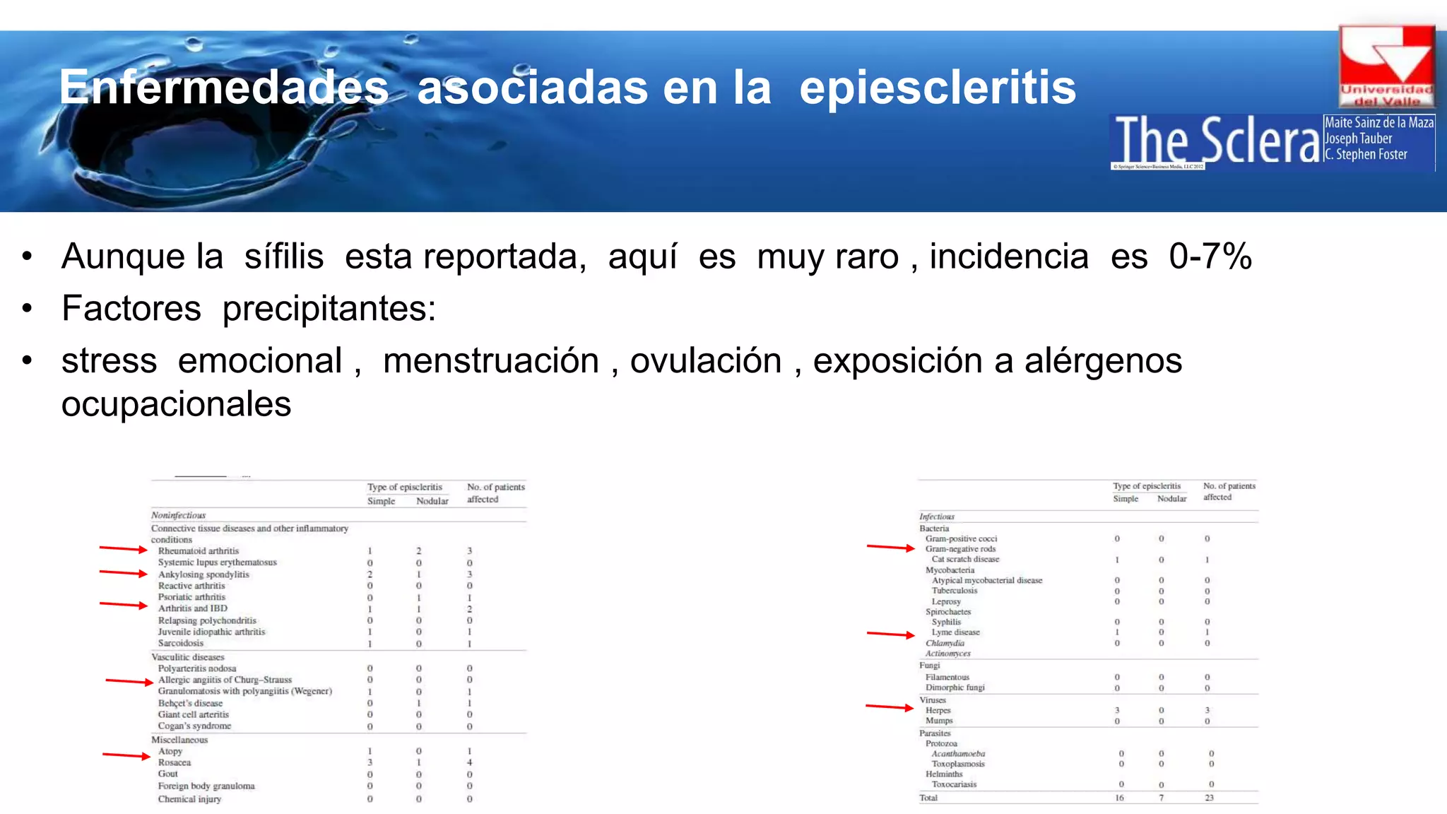 Epiescleritis y escleritis en oftalmologia