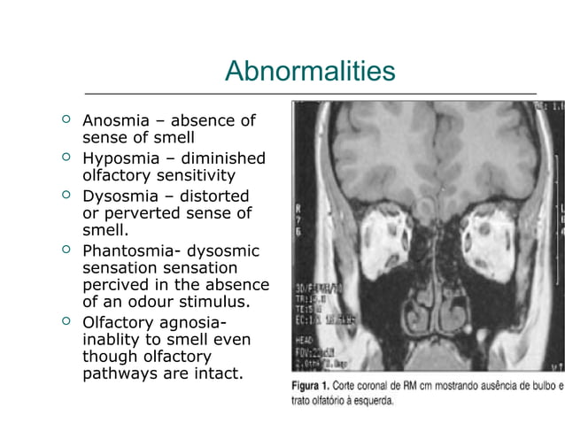 Anatomy & Physiology Of Olfactory System | PPT | Ear, Nose and Throat ...
