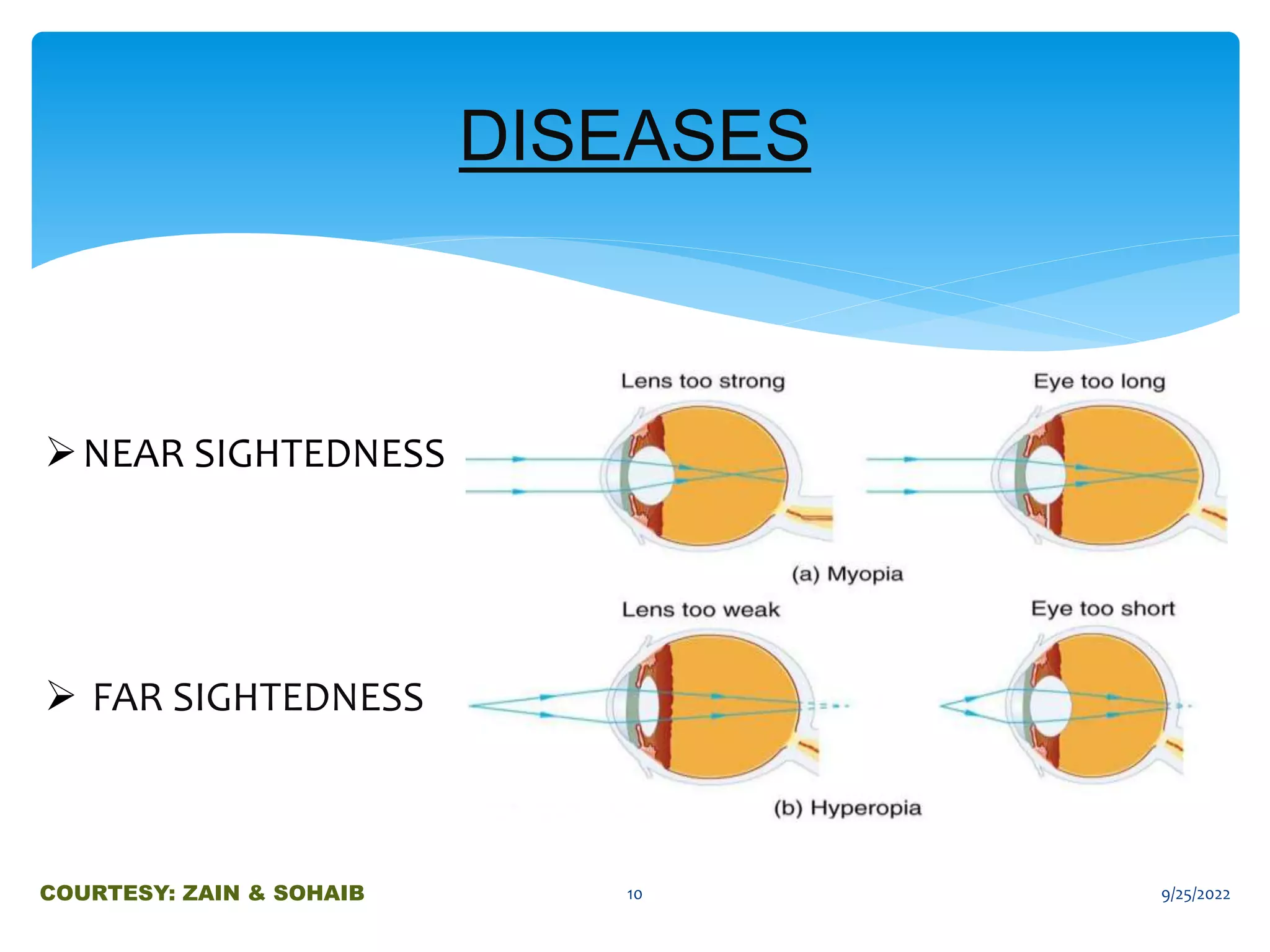 The sense of vision-1.pptx