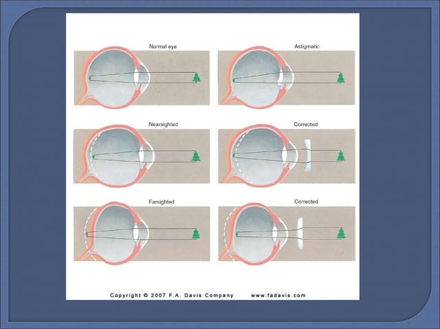 The Sensory Organs, Anatomy and Function | PPT | Eye and Vision ...