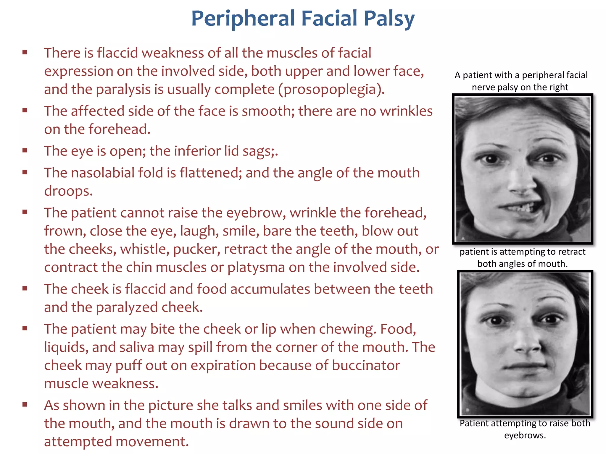 The Seventh Cranial Nerve | PPTX