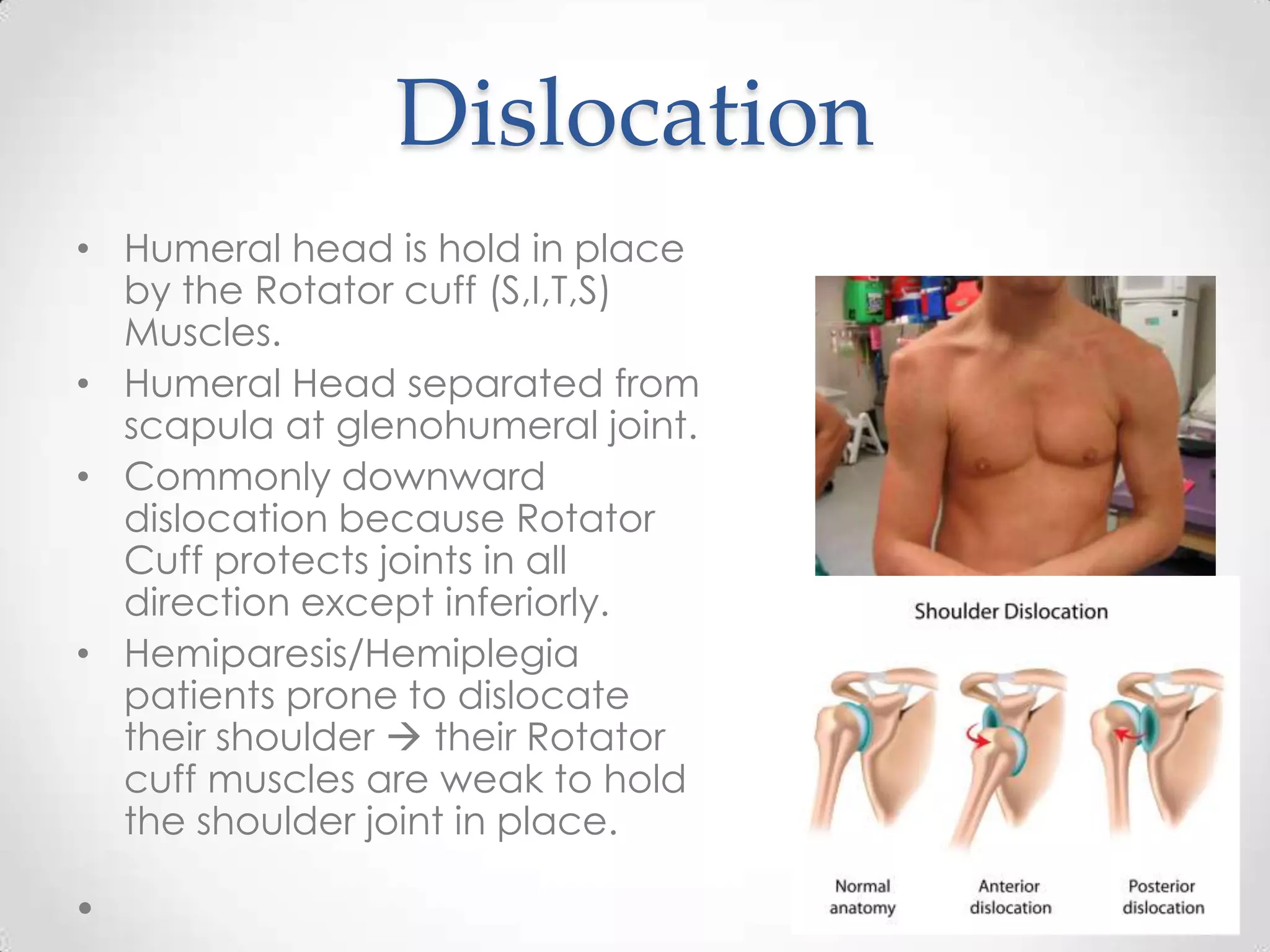 The shoulder joint | PPTX