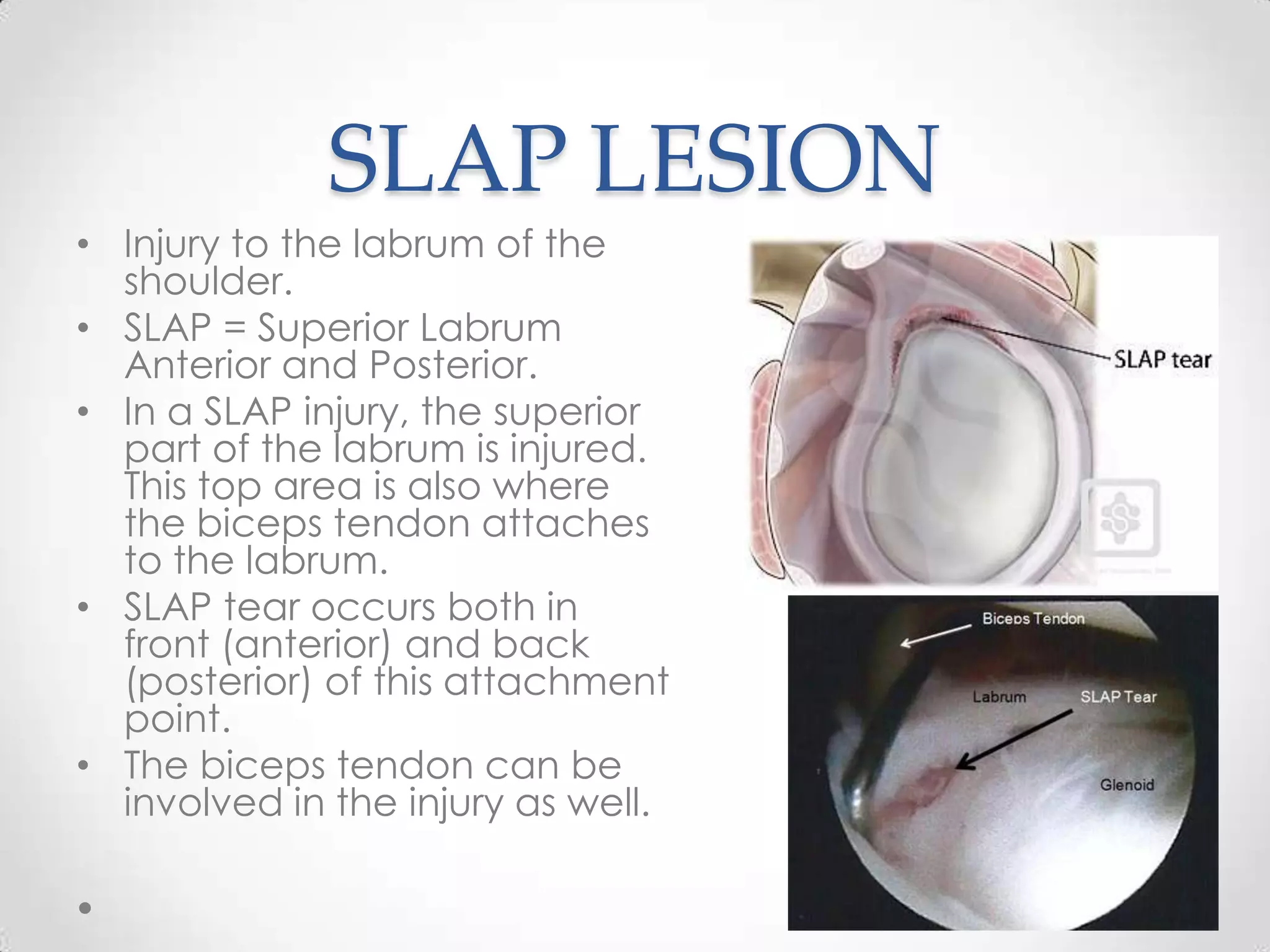 The shoulder joint | PPTX