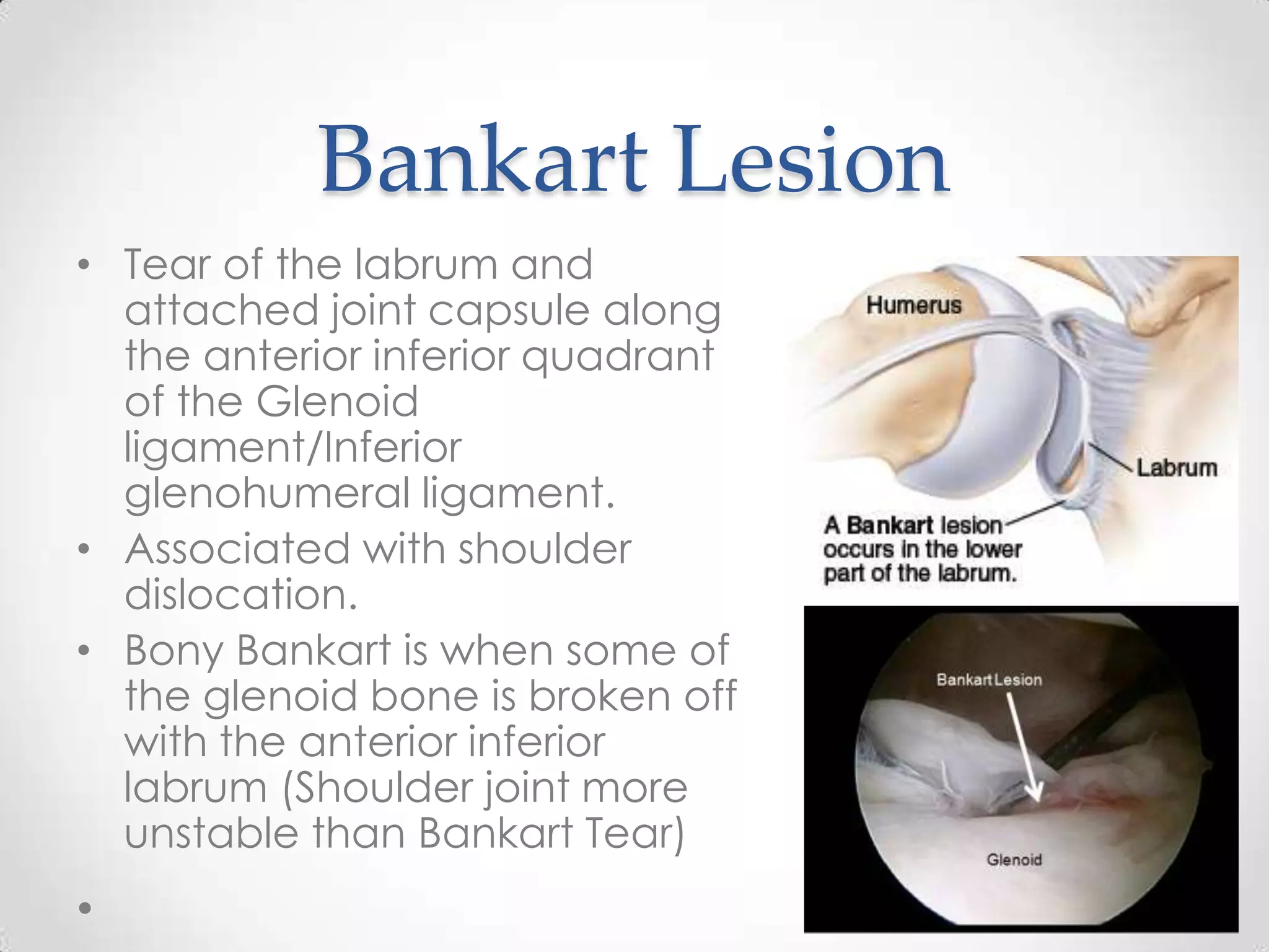 The shoulder joint | PPTX