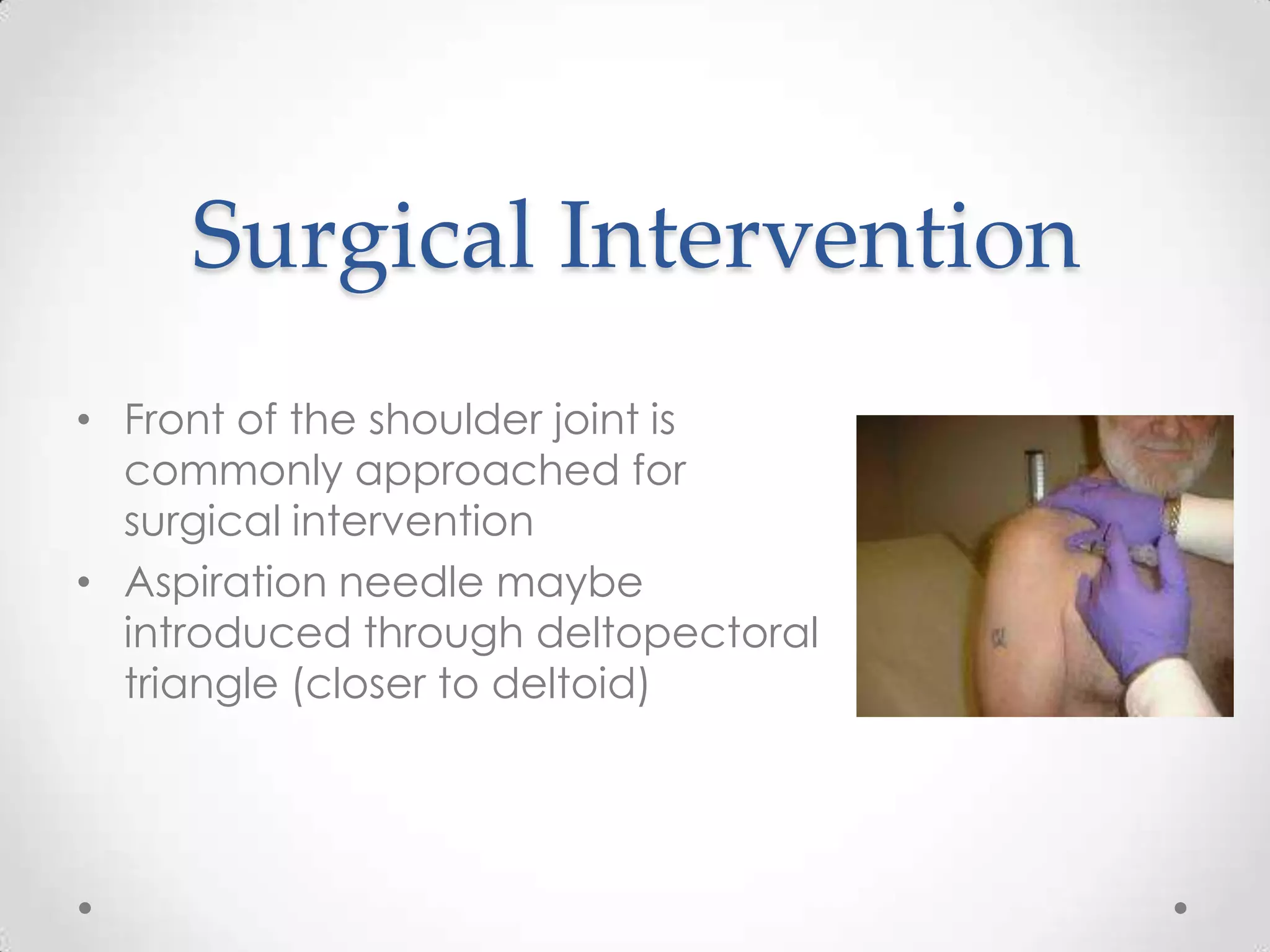 The shoulder joint | PPTX