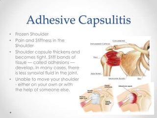 The shoulder joint | PPTX