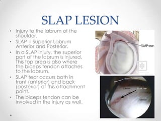 The shoulder joint | PPTX