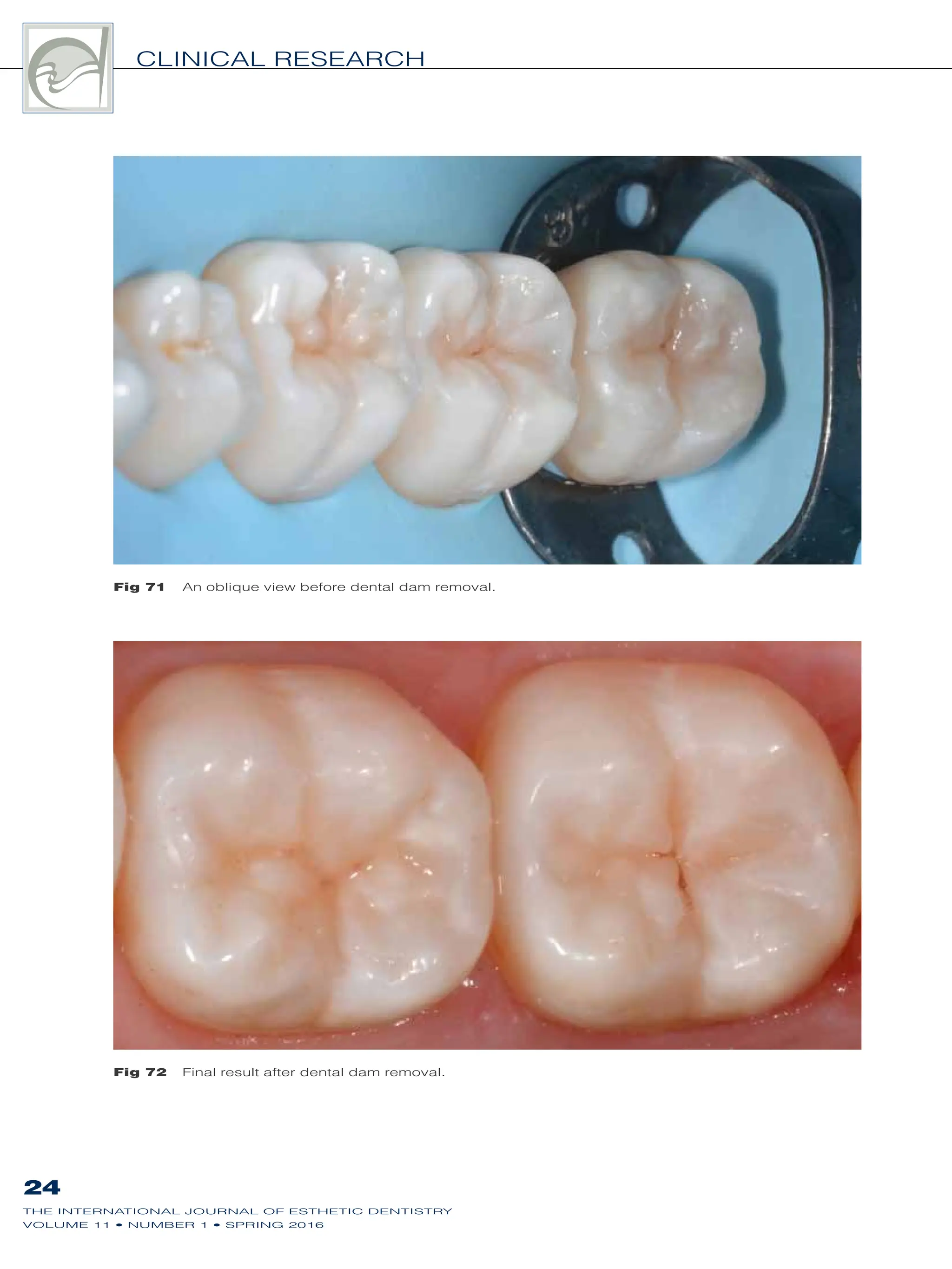 The Simultaneous Modeling Technique In Posteriors Pdf