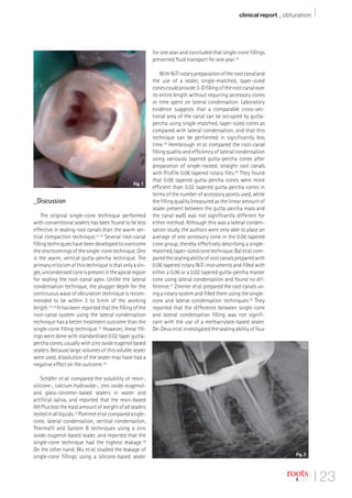 The single matched, taper-sized gutta-percha cone technique | PDF