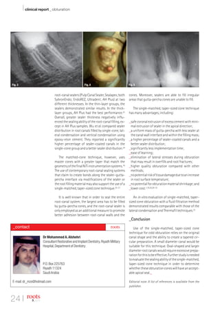The single matched, taper-sized gutta-percha cone technique | PDF