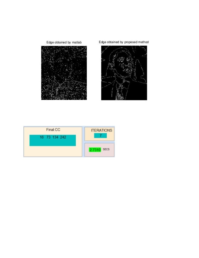 Image Segmentation Using Advanced Fuzzy C Mean Algorithm Fyp Iitr 