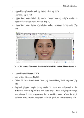 Thesis: A study of gummy smile in a Tunisian orthodontic population. | PDF