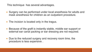 Butterfly Cartilage Tympanoplasty An alternative new technique.pptx