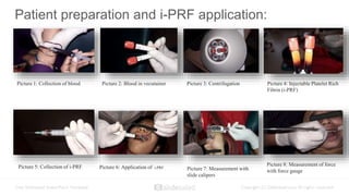 PRF in Orthodontics Thesis Deffence.pptx