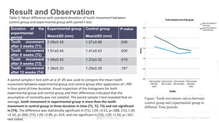PRF in Orthodontics Thesis Deffence.pptx