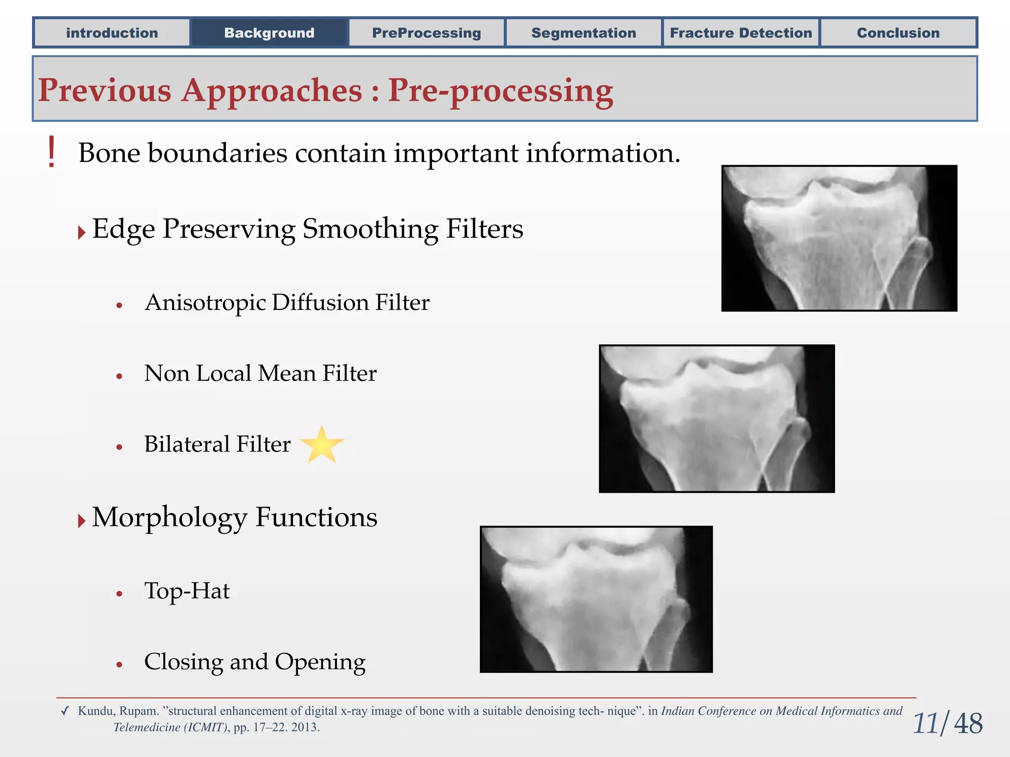 Master thesis - Long Bone Segmentation and Fracture Detection in X-ray Images | PDF