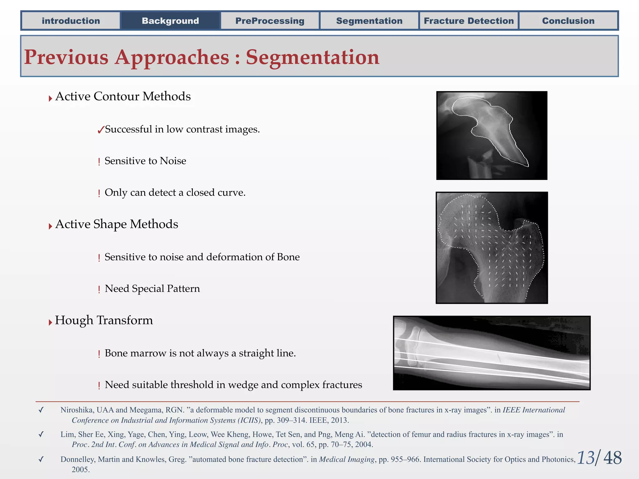 Master thesis - Long Bone Segmentation and Fracture Detection in X-ray ...