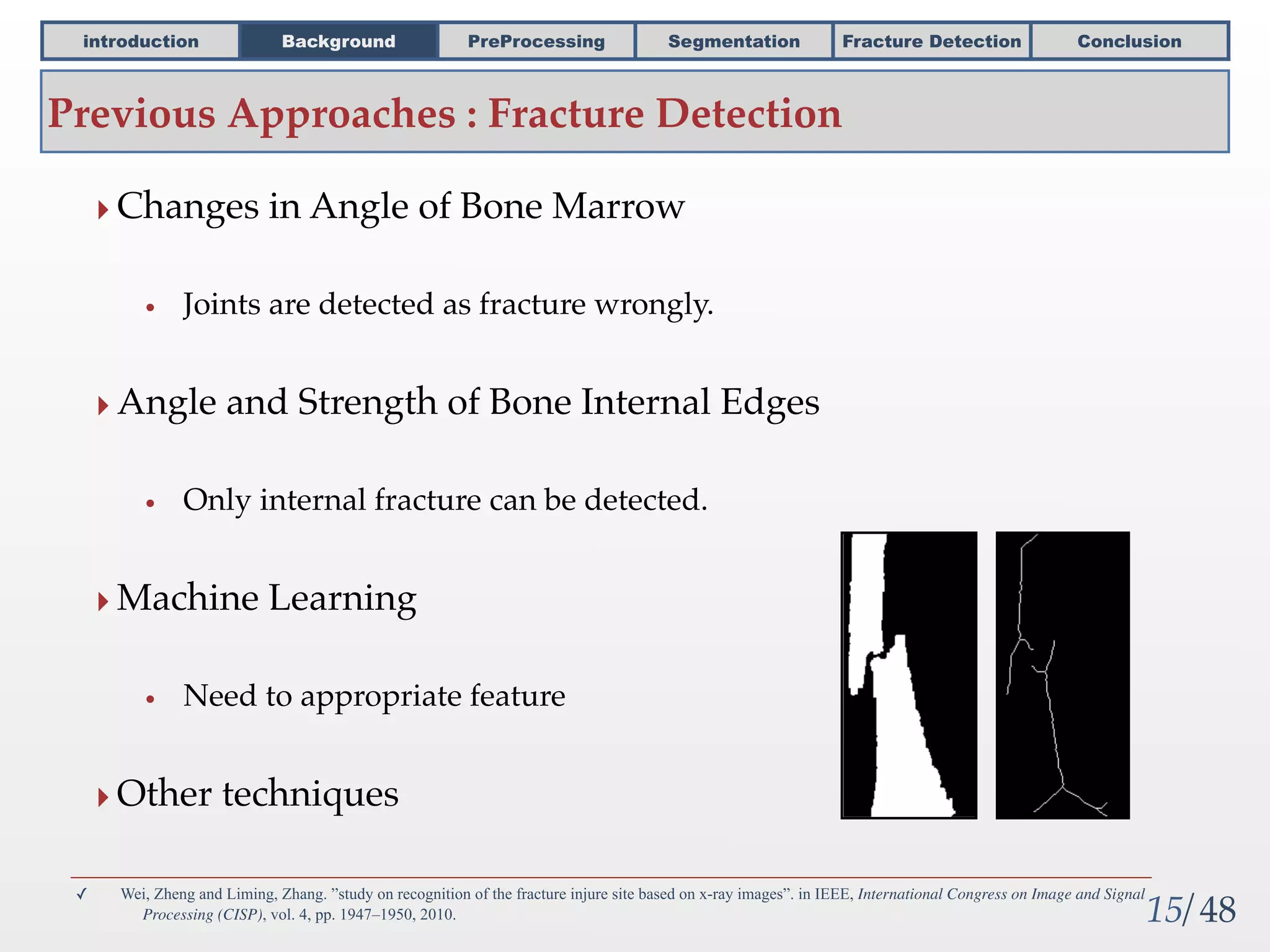 Master thesis - Long Bone Segmentation and Fracture Detection in X-ray Images | PDF