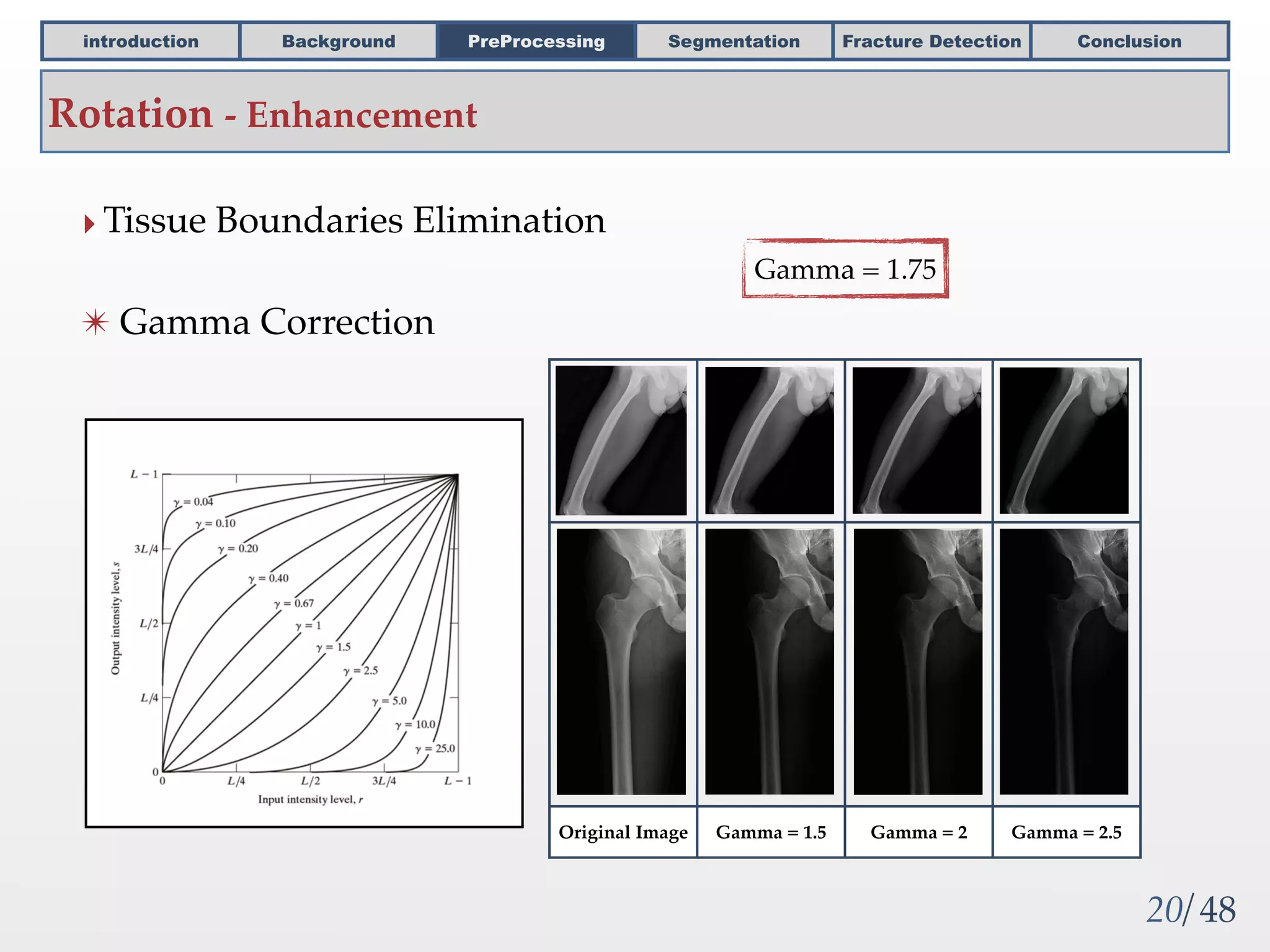 Master thesis - Long Bone Segmentation and Fracture Detection in X-ray Images | PDF