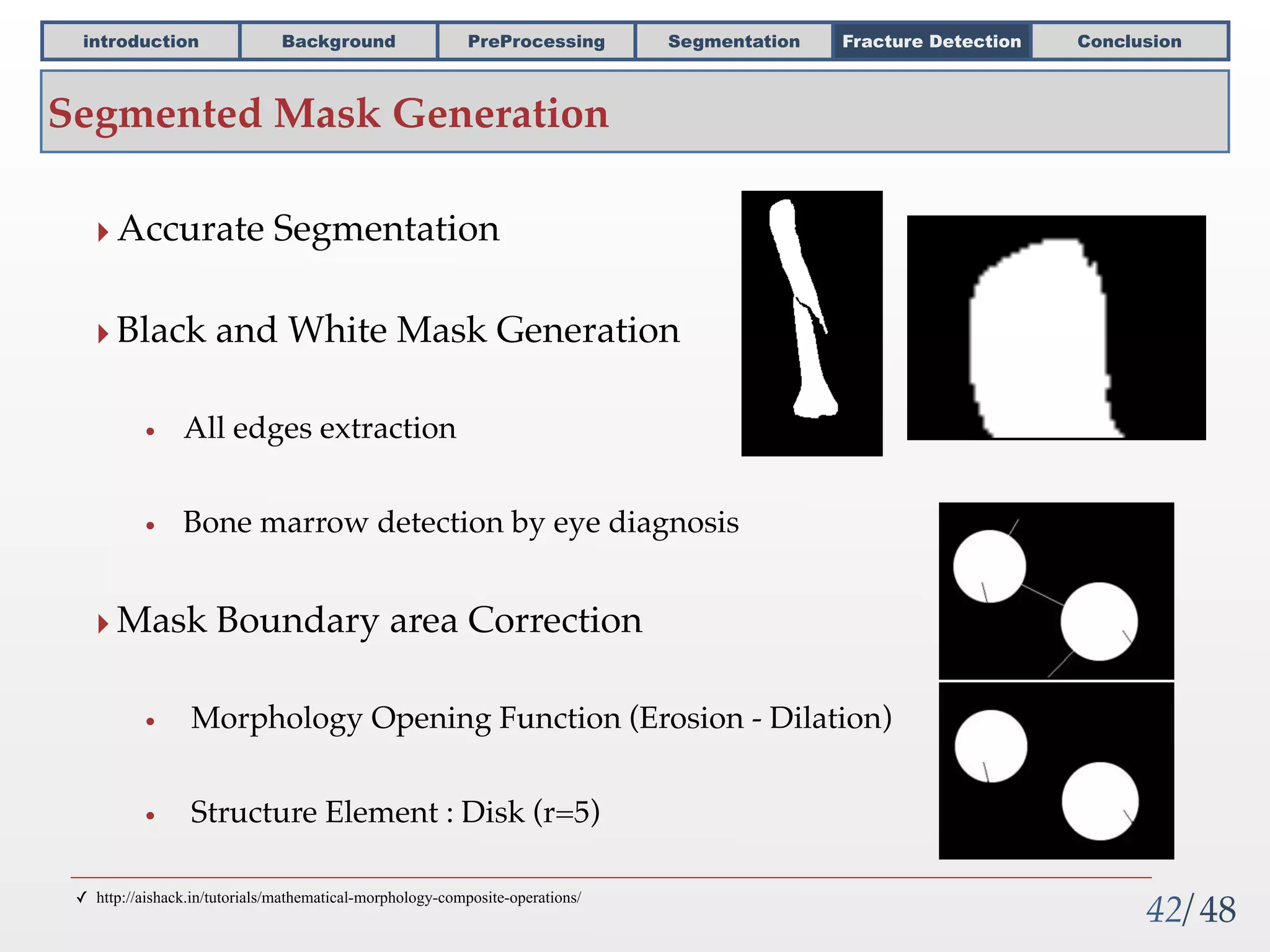 Master thesis - Long Bone Segmentation and Fracture Detection in X-ray Images | PDF