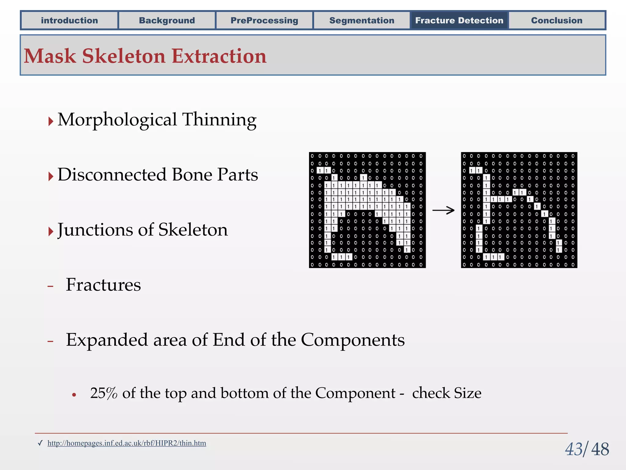 Master thesis - Long Bone Segmentation and Fracture Detection in X-ray Images | PDF