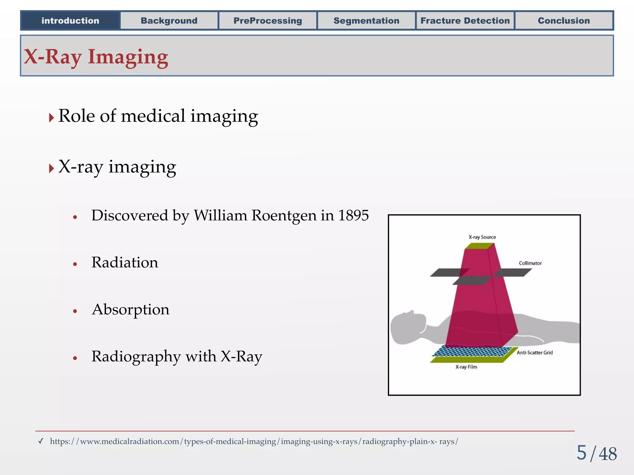 Master Thesis Long Bone Segmentation And Fracture Detection In X Ray