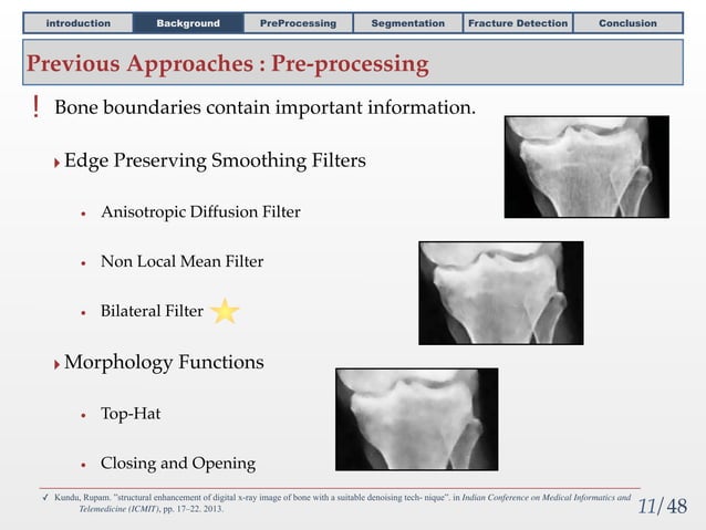 Master thesis - Long Bone Segmentation and Fracture Detection in X-ray Images | PDF